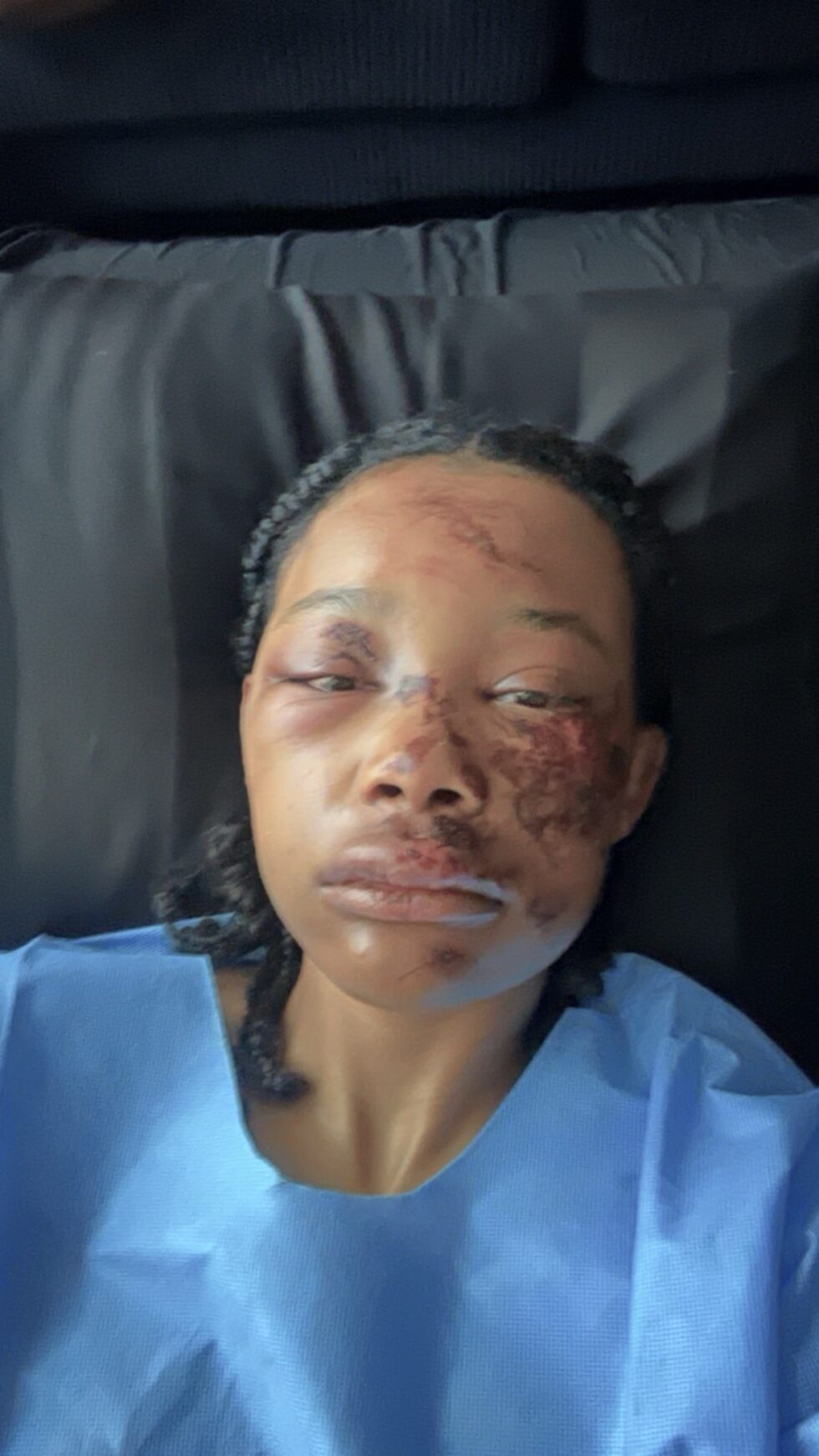 'Beyond grateful to be alive': Victims of alleged racist attack in ...